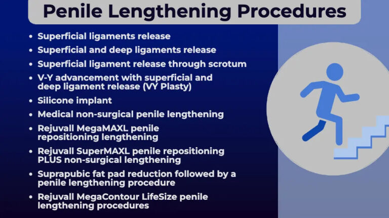 Penile Suspensory Ligament Lengthening-Rejuvall
